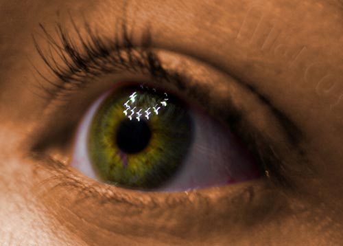 Q&A: What to do about styes?